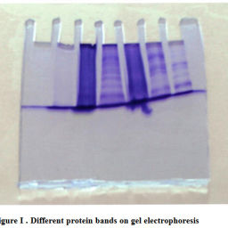Separation of Cancer Proteins using Polyacrylamide Gel Electrophoresis ...