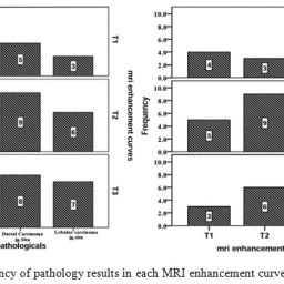 Enhancement Curve of MRI with Contrast in Malignant Breast Lesions ...