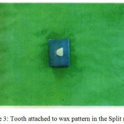 A Comparitive Study on the Tensile Bond Strength of Conventional ...