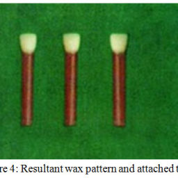 A Comparitive Study on the Tensile Bond Strength of Conventional ...