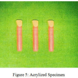 A Comparitive Study on the Tensile Bond Strength of Conventional ...