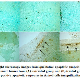 Induction of Apoptotic Mechanism by Streblus Asper Root Extract on ...