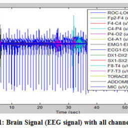 Prediction of REM (Rapid Eye Movement) Sleep Behaviour Disorder using ...