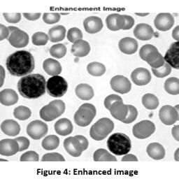 Matlab Based Potent Algorithm for Wbc Cancer Detection and ...