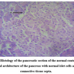 Hypoglycemic and Hypolipidemic Activities of Ethanolic Extract of ...