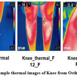 OSTHERSIT- Dataset for Osteoarthritis Analysis using Thermal Images ...