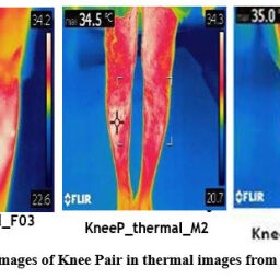 OSTHERSIT- Dataset for Osteoarthritis Analysis using Thermal Images ...