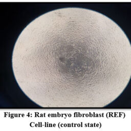 Study the Bacterial Activity Isolated from Colon and Rectal Cancer ...
