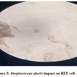 Study the Bacterial Activity Isolated from Colon and Rectal Cancer ...