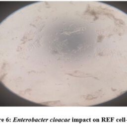 Study the Bacterial Activity Isolated from Colon and Rectal Cancer ...