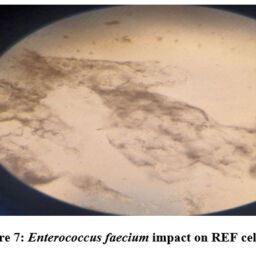 Study the Bacterial Activity Isolated from Colon and Rectal Cancer ...