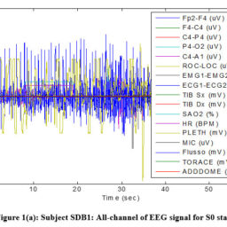 Analysis of Eeg Data Using Different Techniques of Digital Signal ...