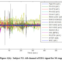 Analysis of Eeg Data Using Different Techniques of Digital Signal ...