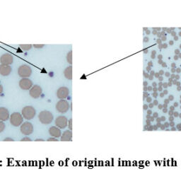 Sequence of Simple Digital Technologies for Detection of Platelets in ...