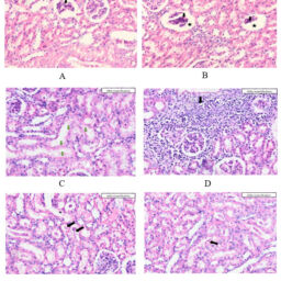 Antiinflammatory and Antioxidant Mediated Nephroprotection of Melatonin ...