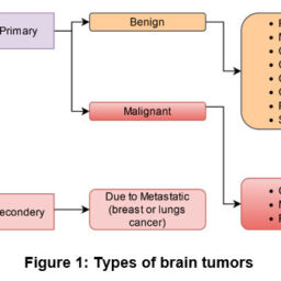 Classification of Brain Tumor Using an Optimized Deep Learning ...