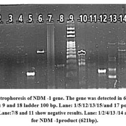 Antimicrobial Susceptibility and Molecular Detection of Carbapenem ...