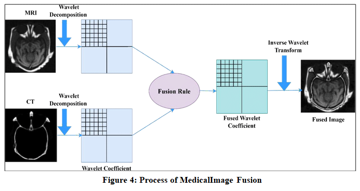 Multimodal Medical Image Fusion: A Review of Imaging Modalities ...